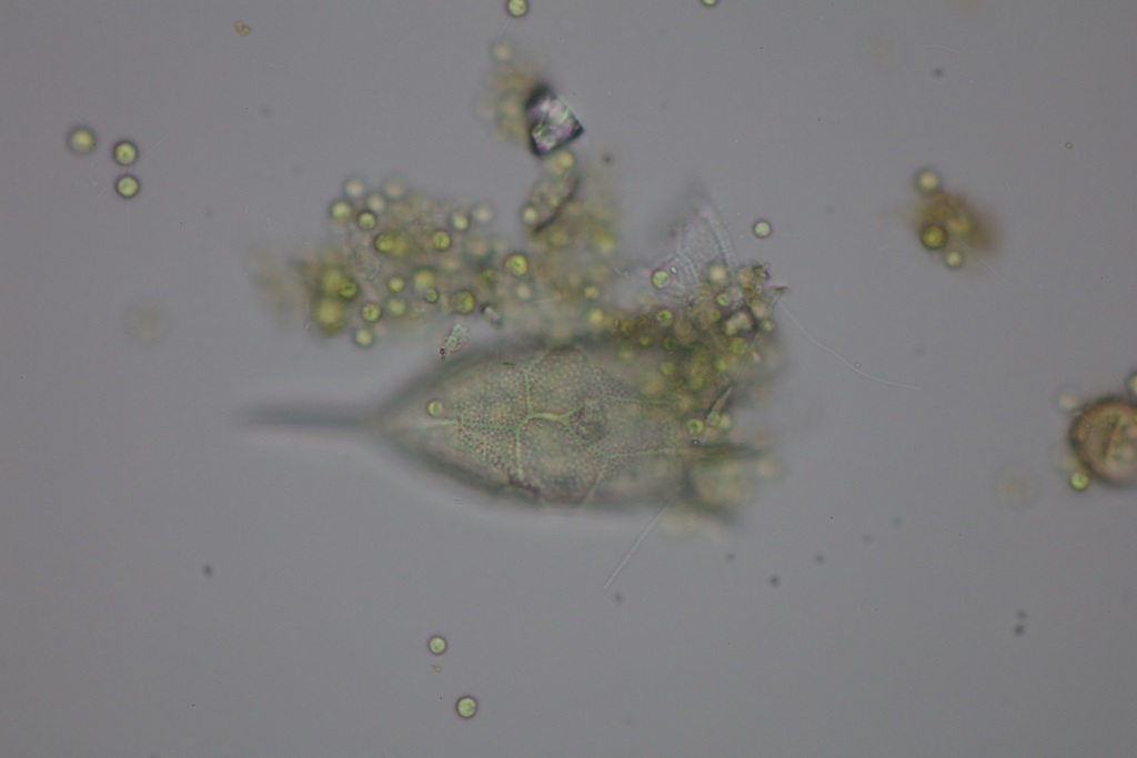 Keratella cochlearis from St. Louis, MO, USA on September 29, 2024 at ...