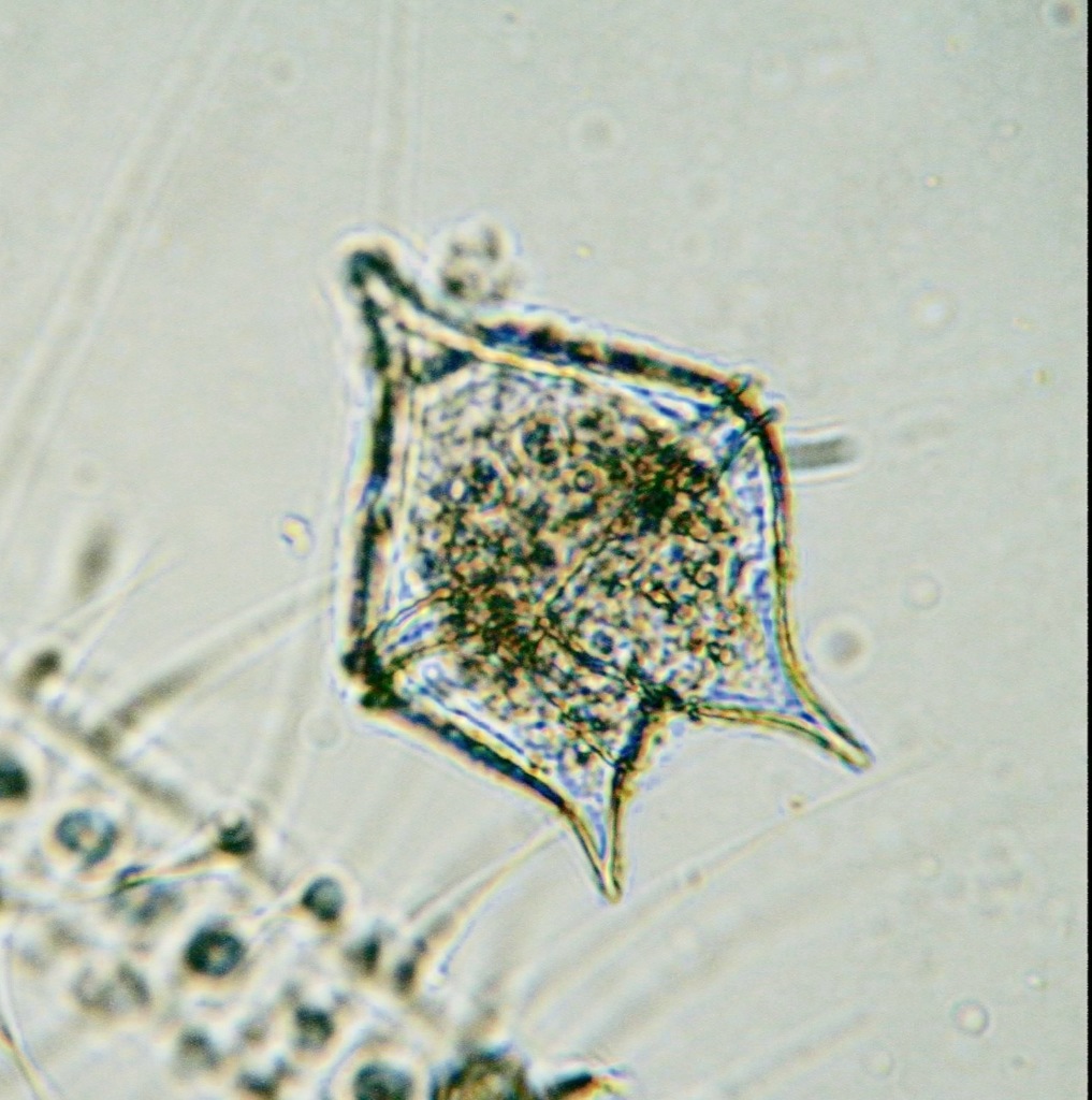 Protoperidinium from Eastsound, wa on July 27, 2016 by Sarka Martinez ...