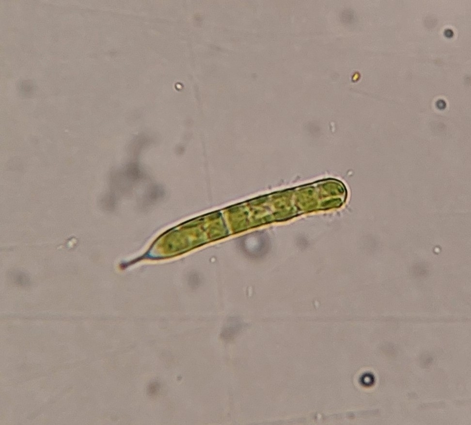 Ophiocytium from 09117 Vilnius, Lietuva on October 11, 2024 at 06:49 PM ...