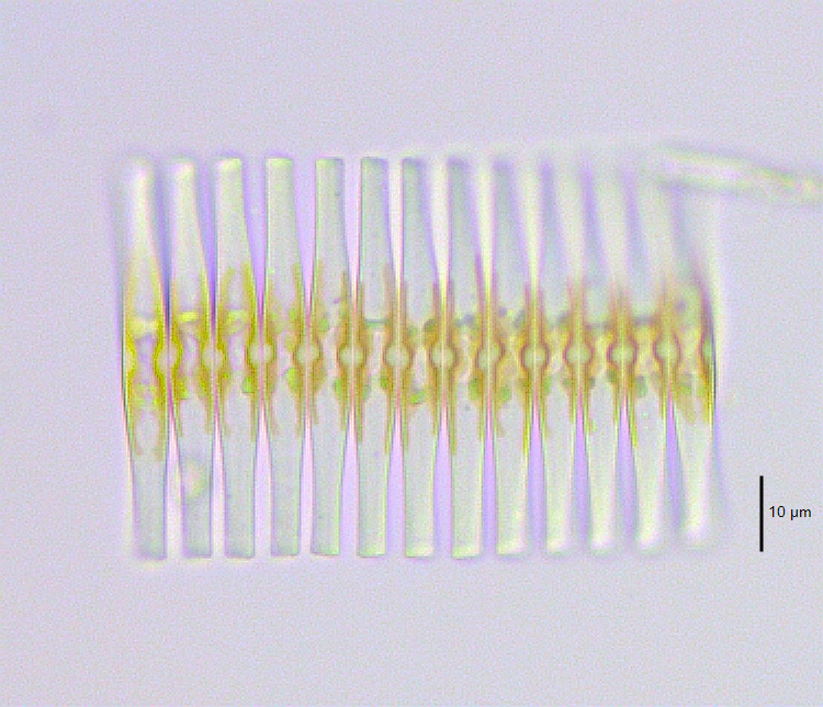 Fragilaria crotonensis (Encyclopedia of Diatoms Found in the USA ...