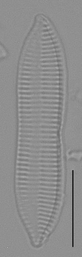 (Tryblionella)