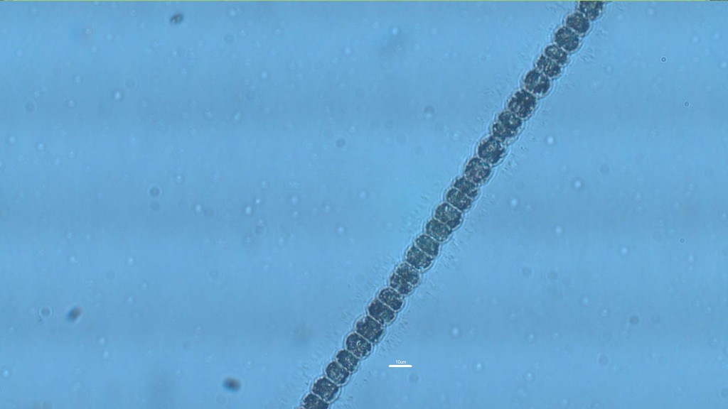 Dolichospermum from mashapaug pond ri on May 21, 2019 by Bryan Milstead ...