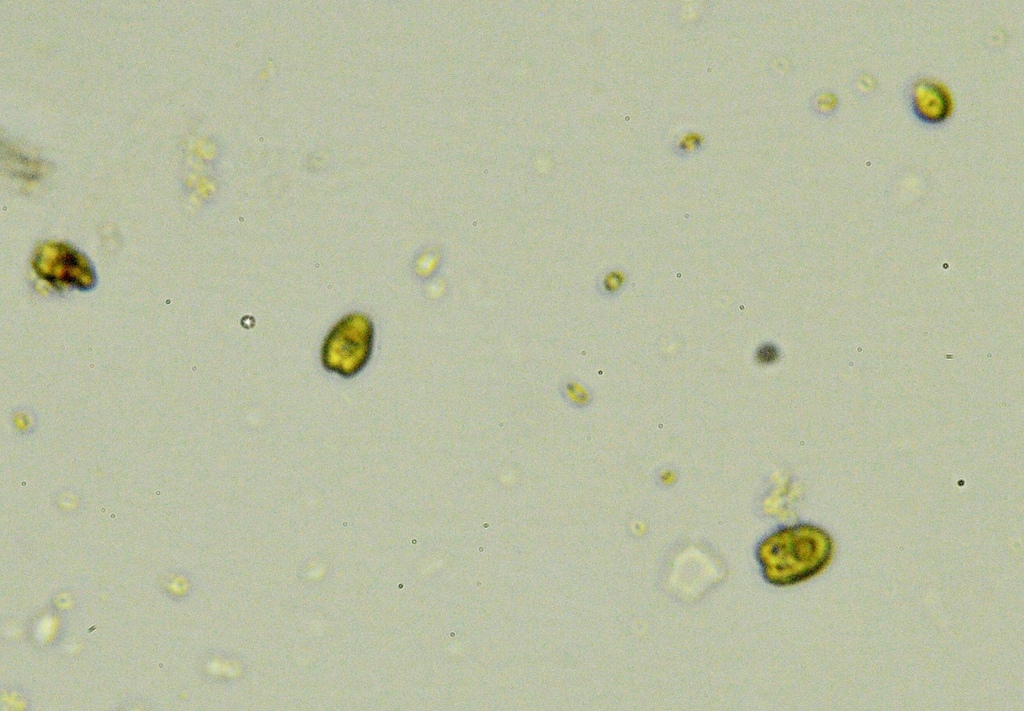 Prasinophyceae from East Sound, , WA, US on June 16, 2019 at 02:09 PM ...