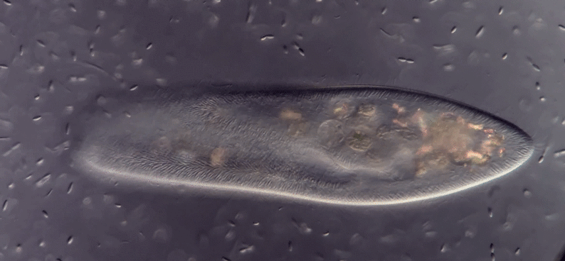 Paramecium caudatum from North Fork, Northville, NY, USA on October 25 ...