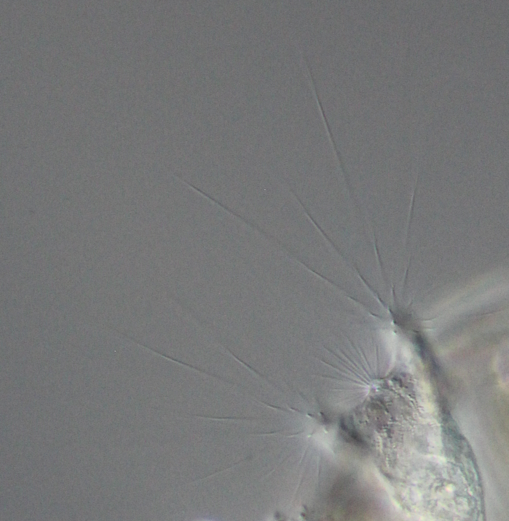 Collotheca ornata from Brokenhead Wetland Interpretive Trail, 1 km ...