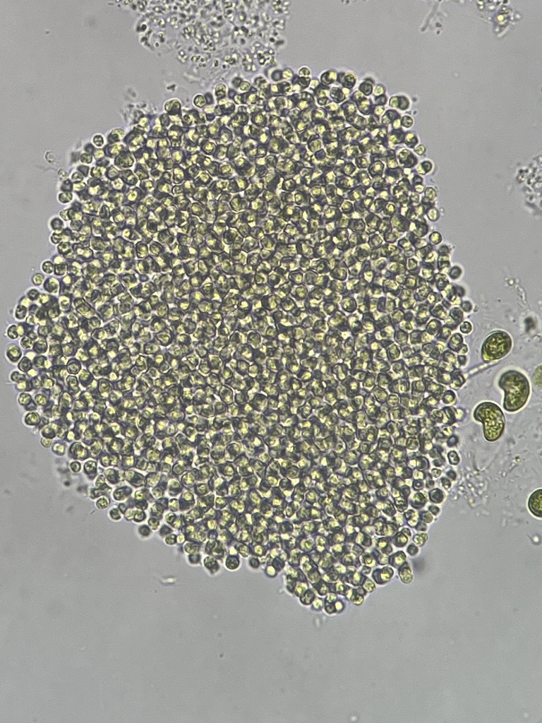 Microcystis flos-aquae from Oblastní nemocnice Kladno, Kladno ...