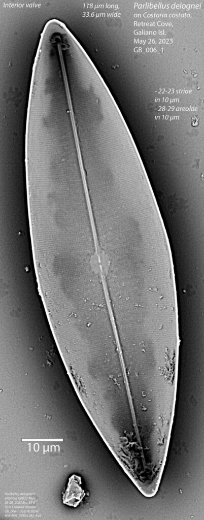Parlibellus delognei from Retreat Cove, Trincomali Channel, Galiano ...