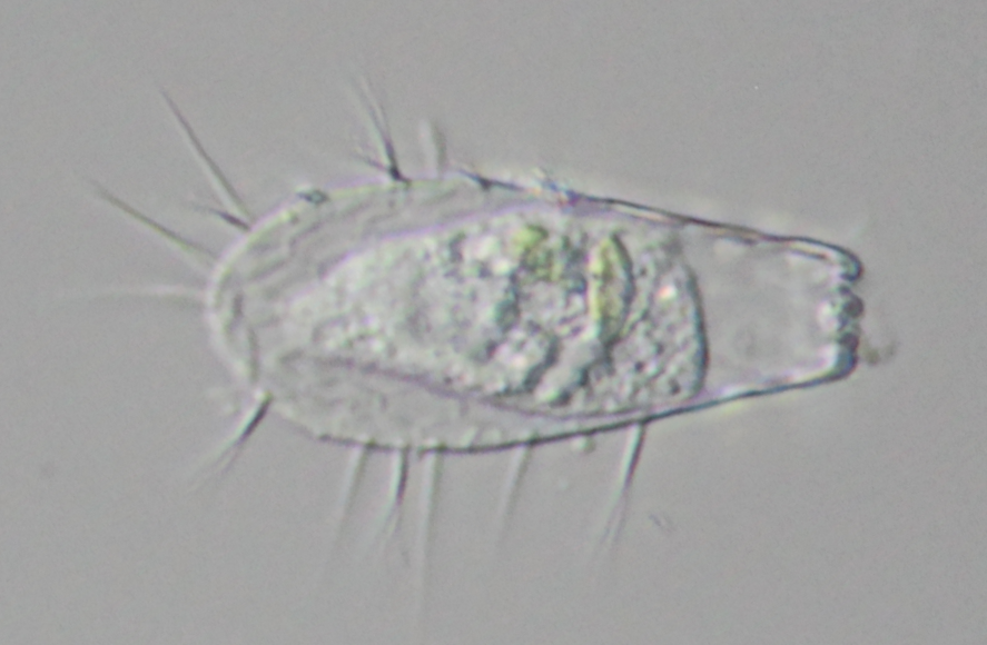 Euglypha filifera from Brokenhead Wetland Interpretive Trail, 1 km ...