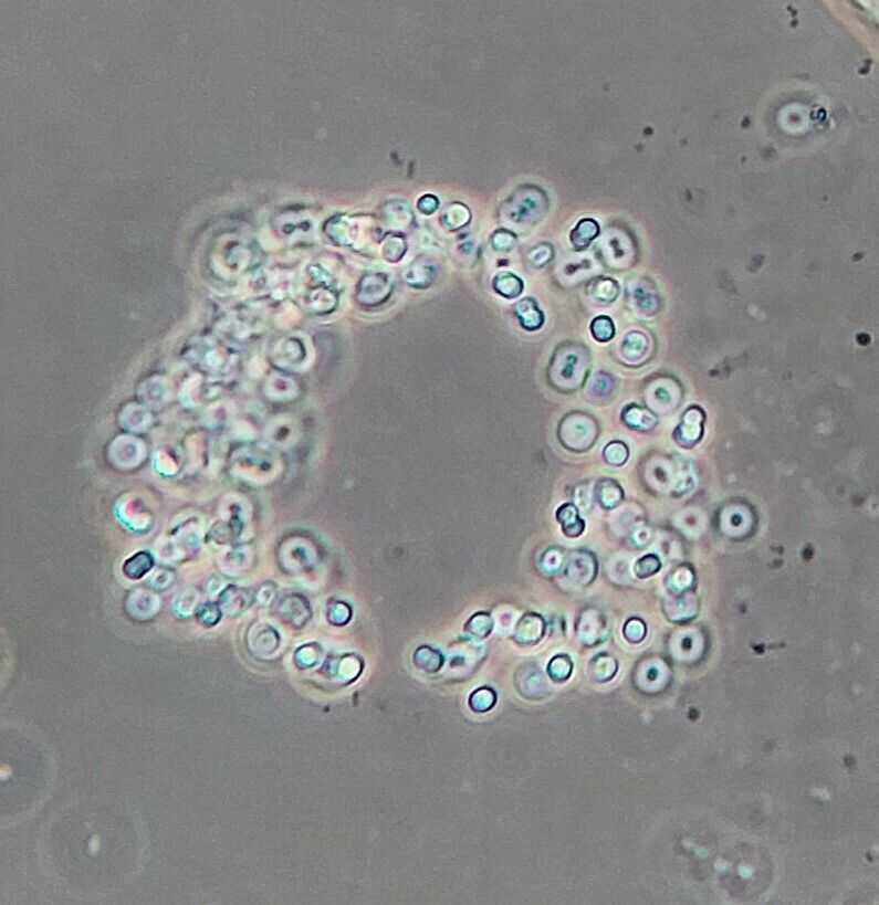 Aphanocapsa annulata from Brisbane QLD, Australia on January 29, 2025 ...