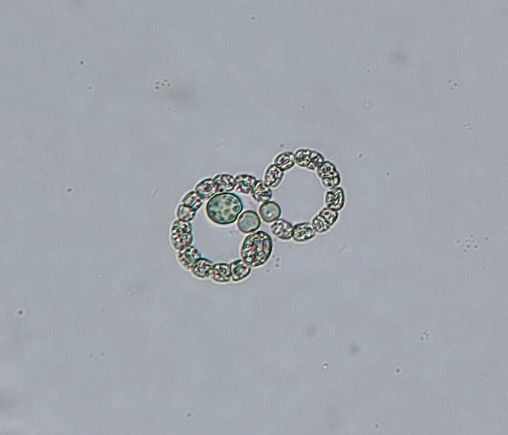 Sphaerospermopsis from Brisbane QLD, Australia on January 29, 2025 at ...
