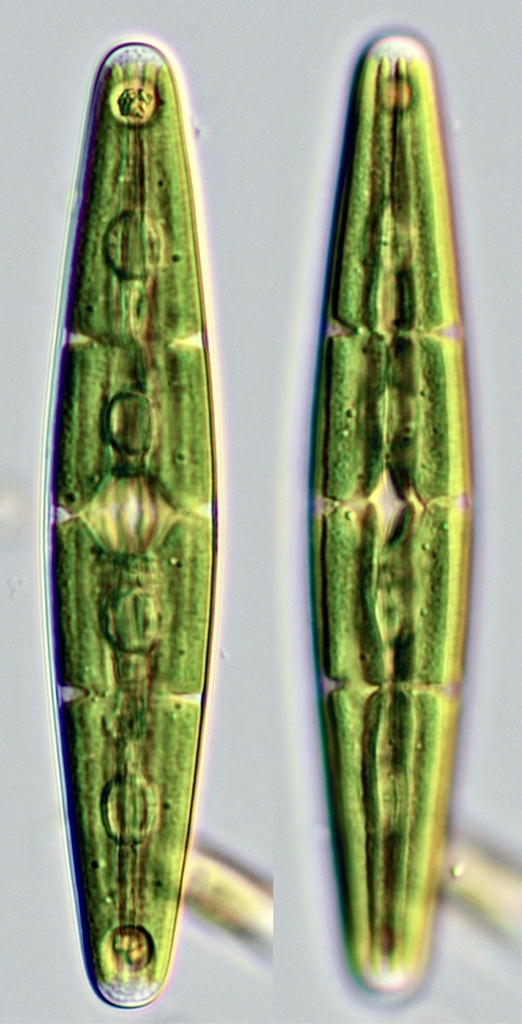 Closterium closterioides intermedium from Brisbane QLD, Australia on ...