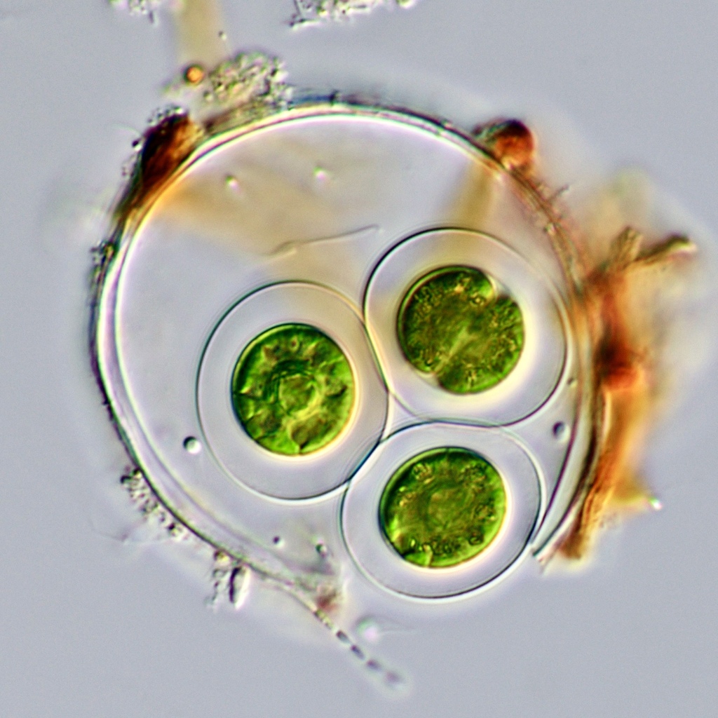 Asterococcus limneticus from Brisbane QLD, Australia on February 1 ...