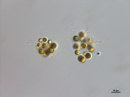 (Sphaerocystis planctonica)