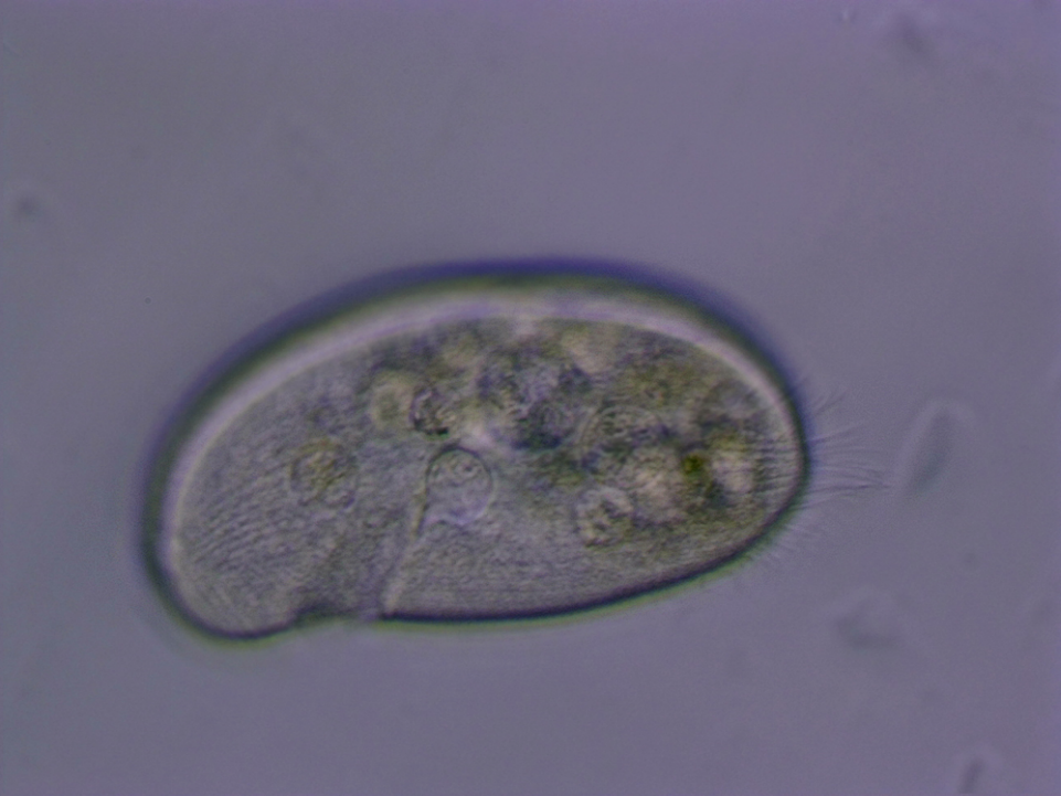 Colpidium colpoda from Chester County, PA, USA on February 28, 2025 at ...