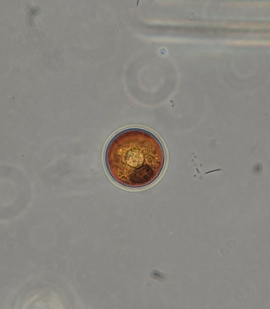 Tubulinea from Brisbane QLD, Australia on March 2, 2025 at 10:45 AM by ...