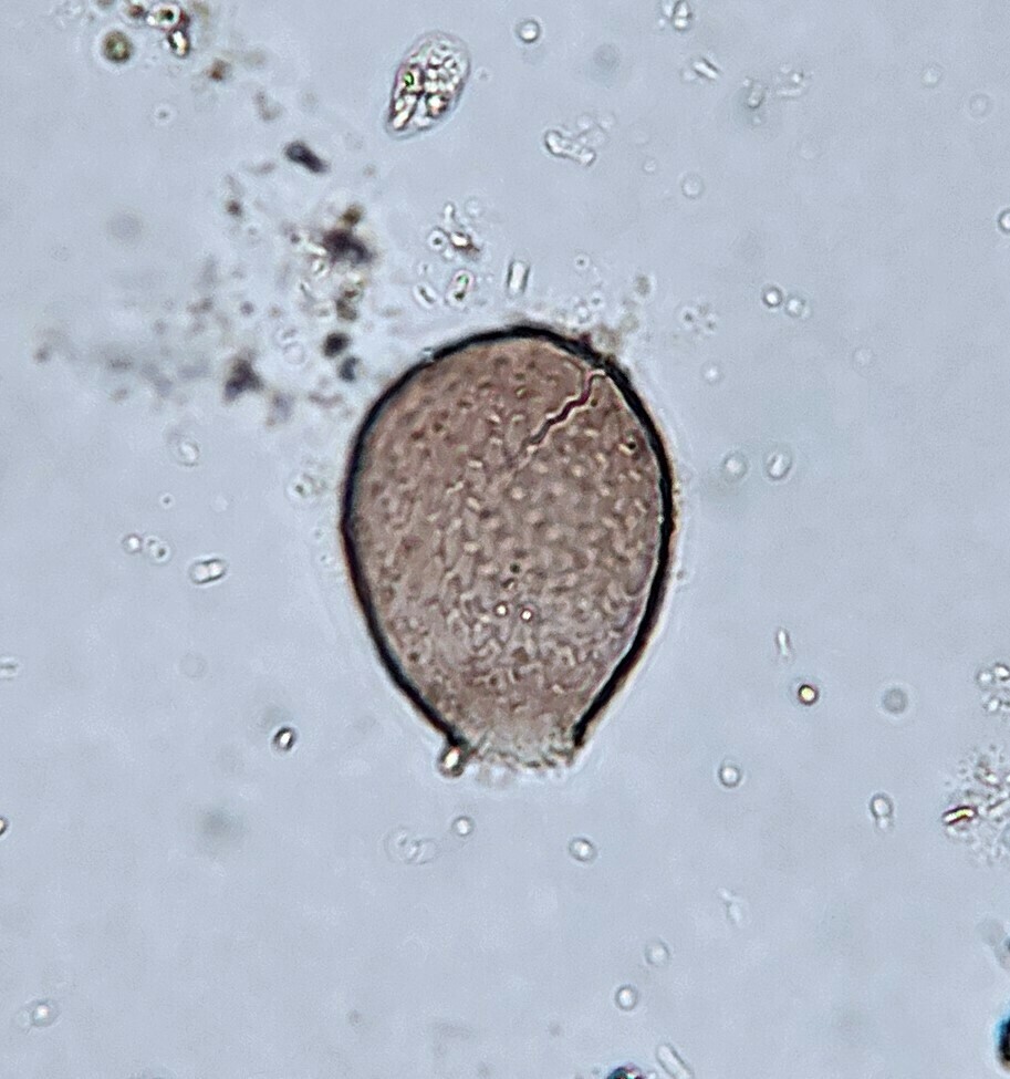 Assulina from Ebor NSW 2453, Australia on May 2, 2018 at 09:34 PM by ...