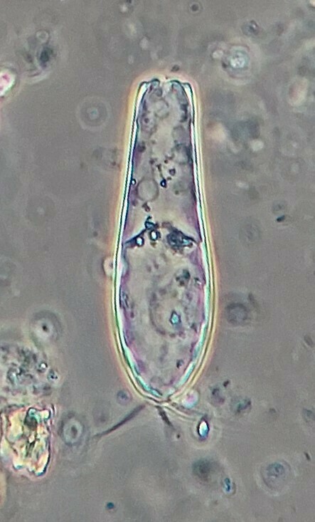 Euglypha cristata from Ebor NSW 2453, Australia on May 02, 2018 at 10: ...