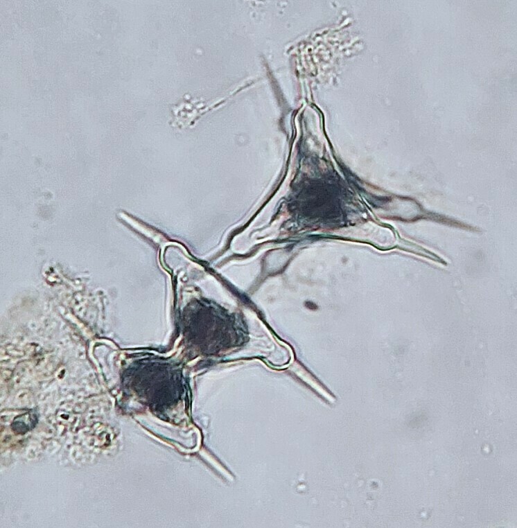 Staurodesmus unicornis in January 2017 by Alex Kenins. Lugols preserved ...