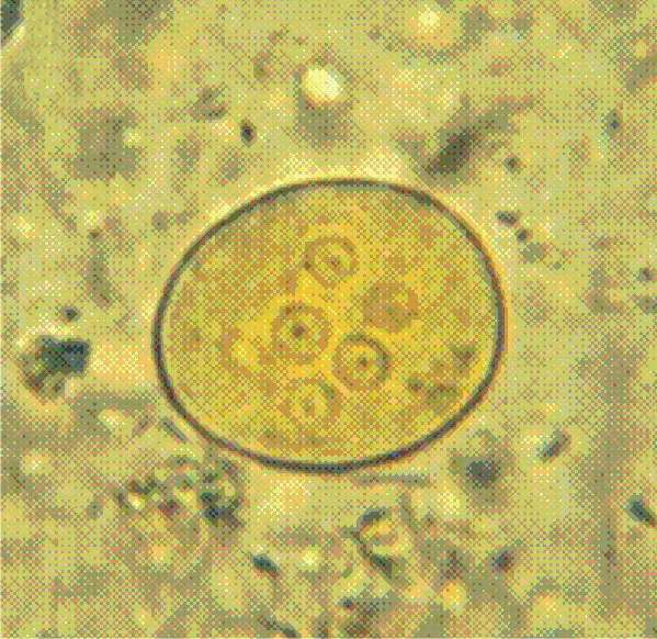 Morfologia Da Entamoeba Coli
