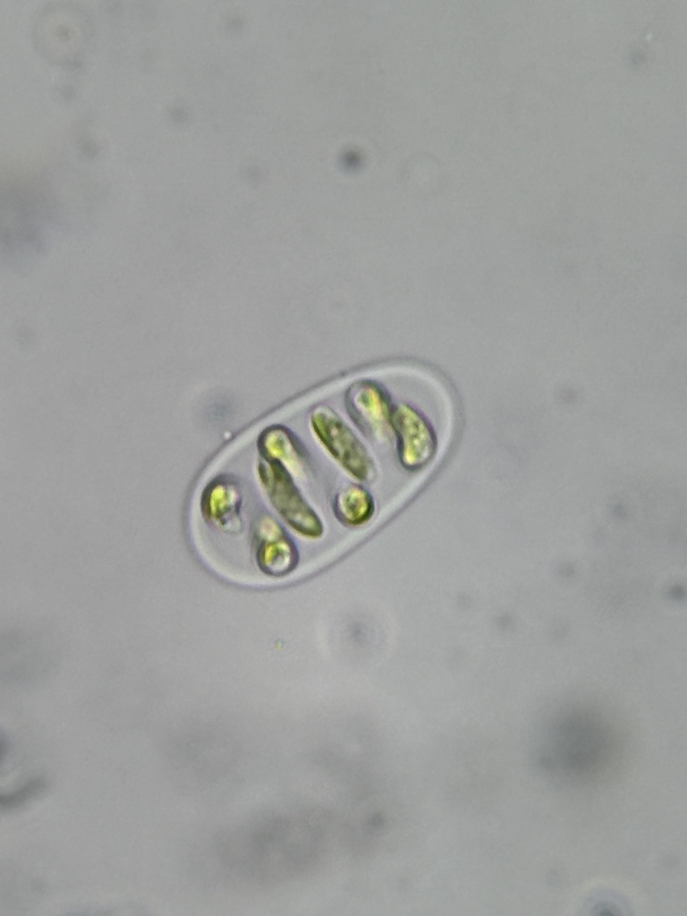 Nephrocytium from Bassett Park, Buffalo, NY, US on April 19, 2025 at 10 ...