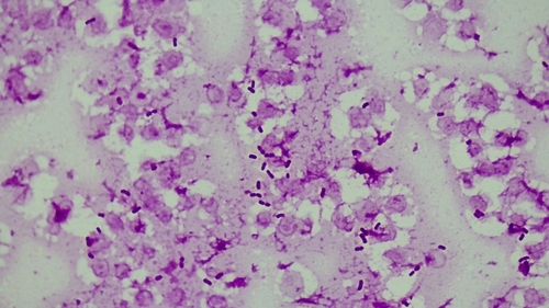 Moraxella osloensis · iNaturalist