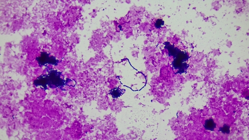 Streptococcus intermedius · iNaturalist