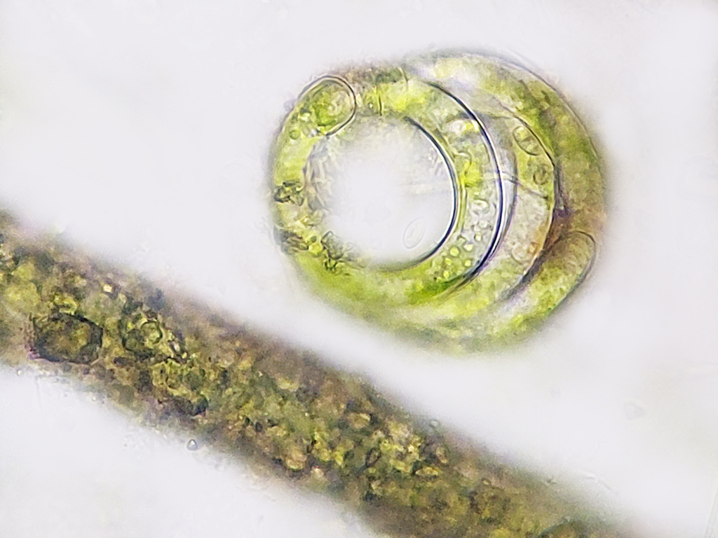 Ophiocytium from Berlin-Bezirk Steglitz-Zehlendorf, Deutschland on ...
