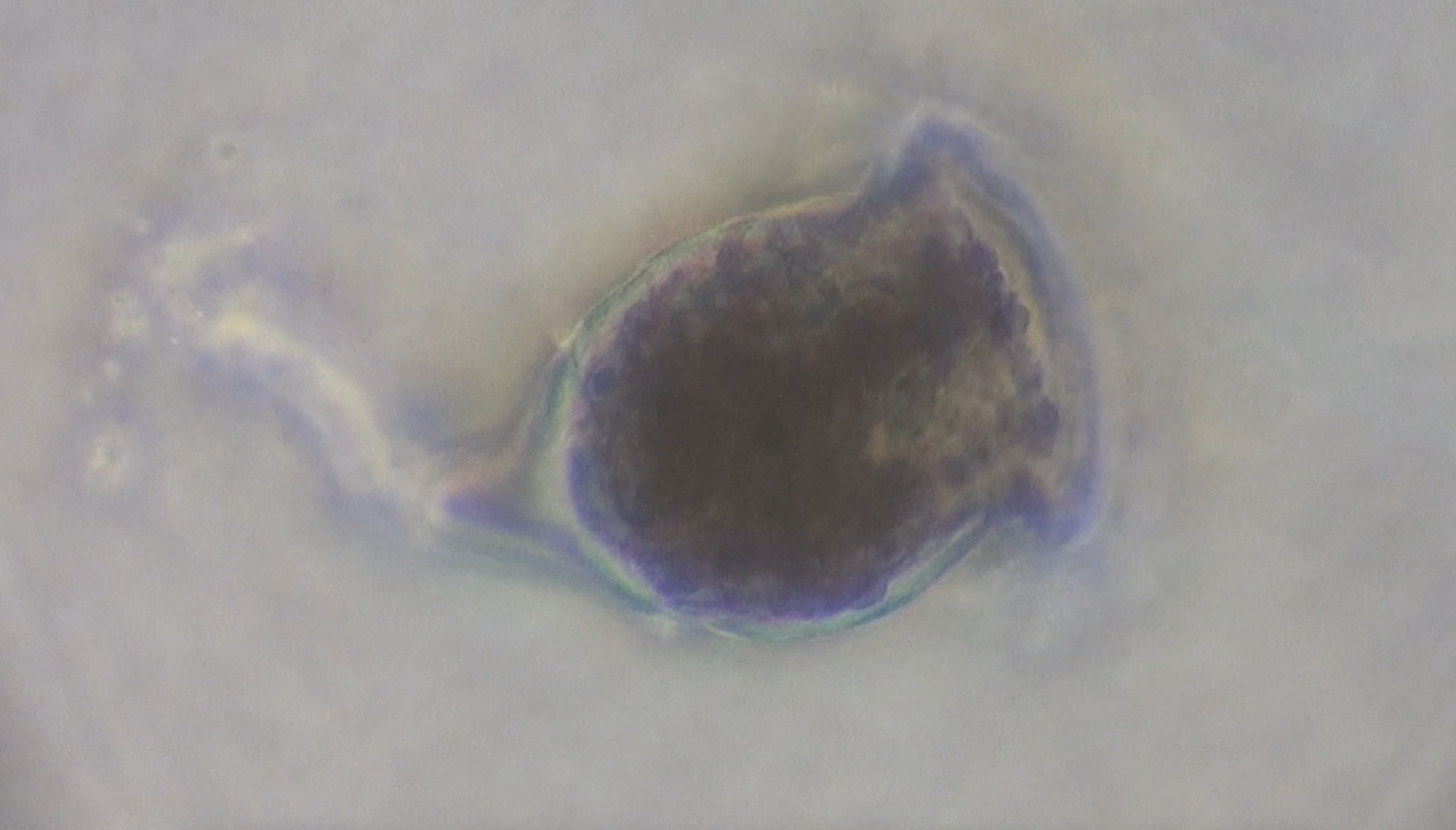 Campanella umbellaria (Linnaeus, 1758) Goldfuss, 1820