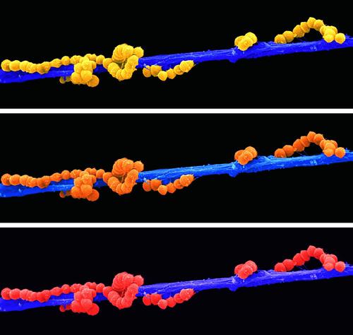 enterobacteria and allies (Order Enterobacteriales) · iNaturalist