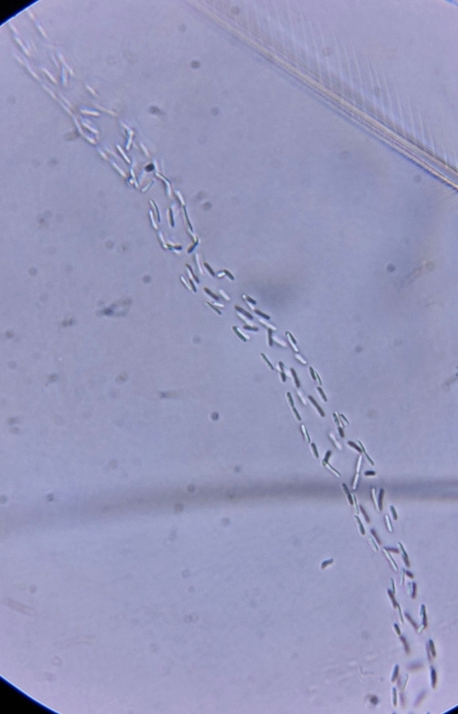 Rhabdoderma from RHMQ+53X Аэропортинский пруд, Бишкек, Кыргызстан on ...