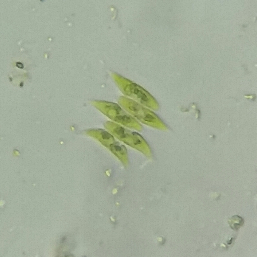 (Tetradesmus dimorphus) - Botanical Realm
