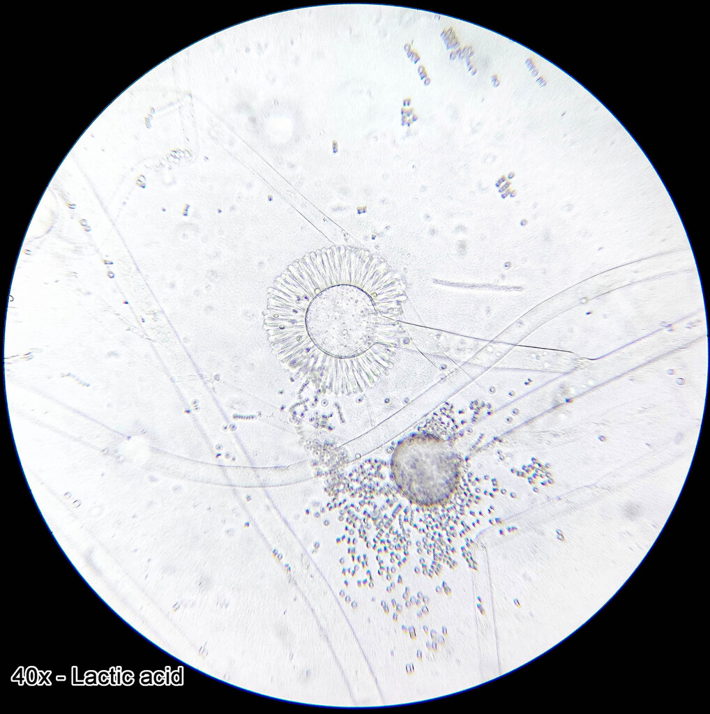 Syncephalastrum racemosum from 65600 Hidalgo, N.L., México on June 16 ...