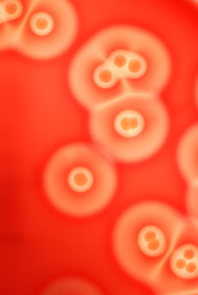 staph aureus from Ottawa, ON, Canada on June 1, 2008 at 07:53 PM by ...