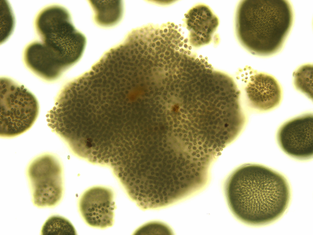 Microcystis aeruginosa from Chisago County, MN, USA on November 9, 2016 ...