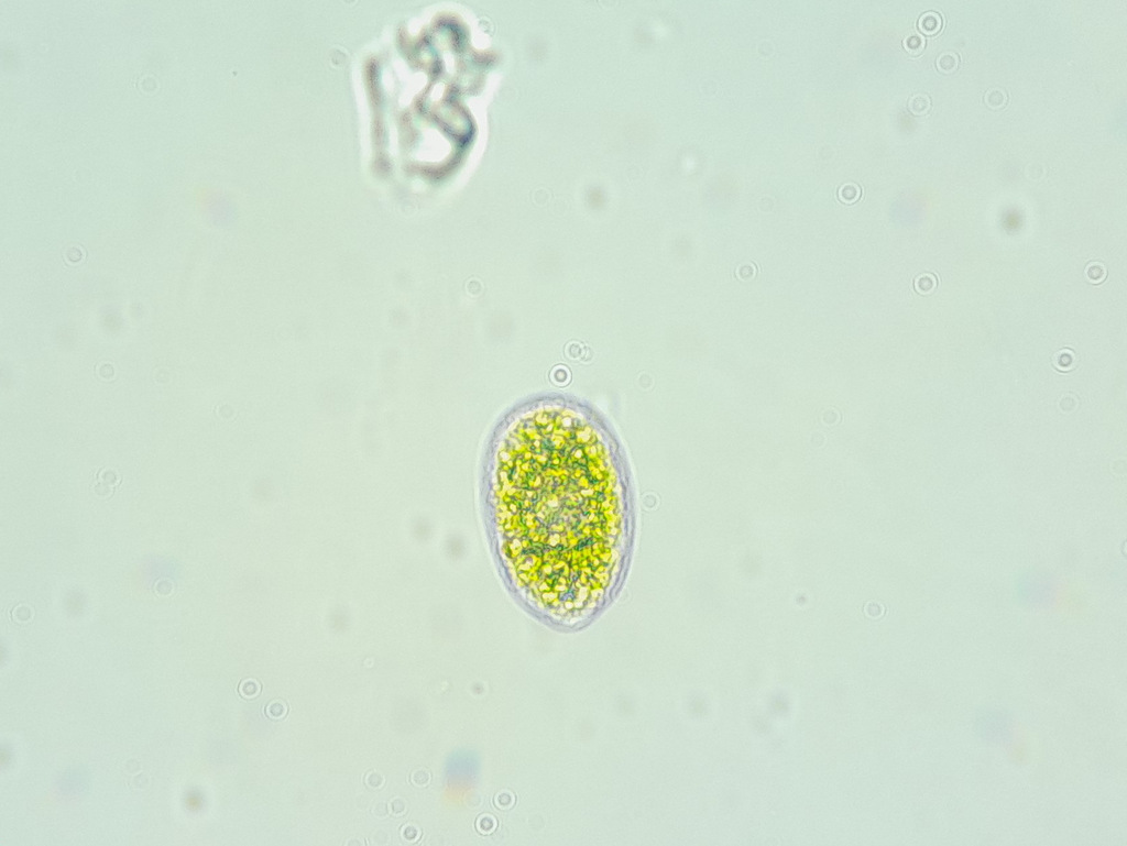 Mesotaenium from Nemojany, Česko on October 12, 2025 at 10:22 PM by ...