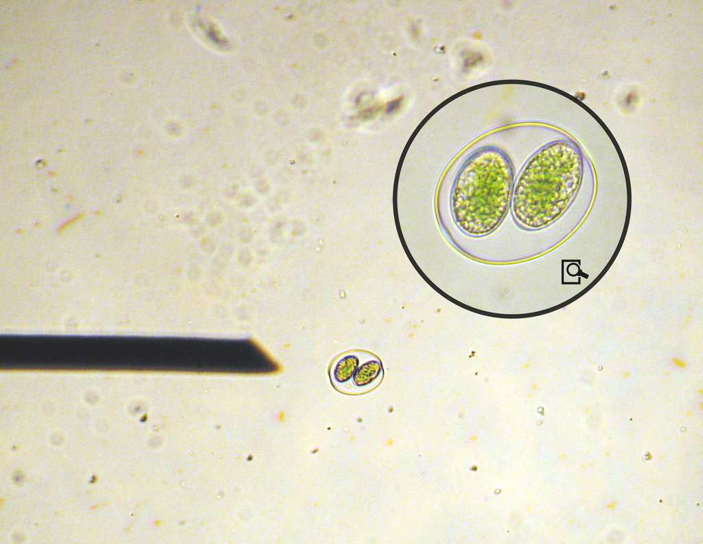 glaucophyte algae (Glaucophyta) - Botanical Realm