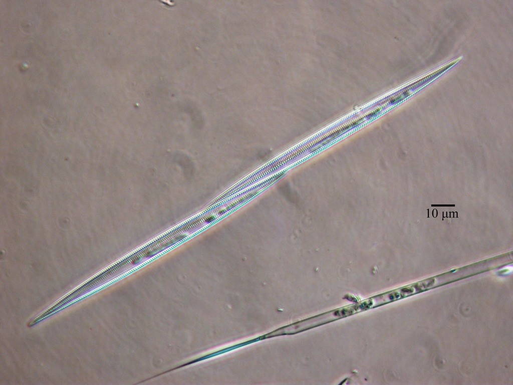 Pseudo-nitzschia from Trincomali Channel, Galiano Island, BC on July 6 ...