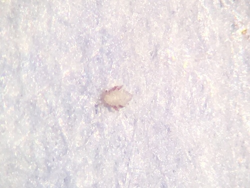 Myocoptes musculinus · iNaturalist