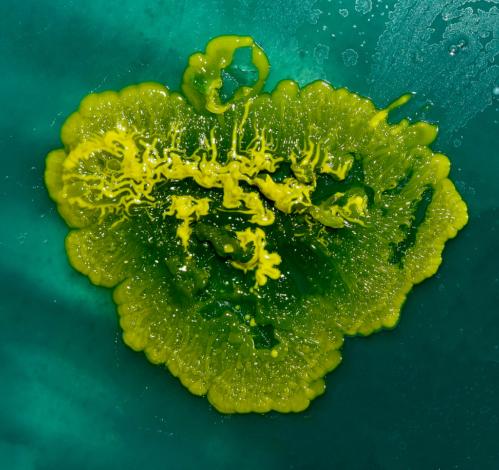 Sphingomonas phyllosphaerae from Oakland, California on March 02, 2017 ...