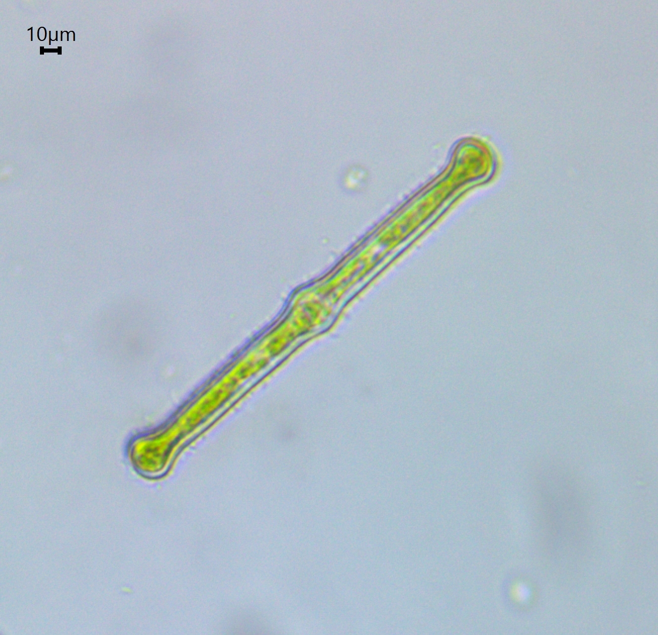 Tabellaria fenestrata (Lyngbye) Kützing, 1844