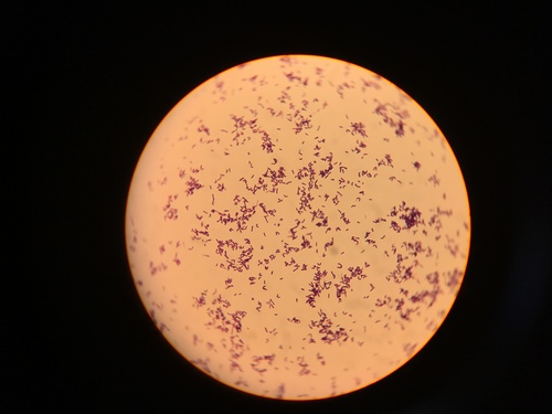 Klebs-Löffler bacillus (Corynebacterium diptheriae) · iNaturalist