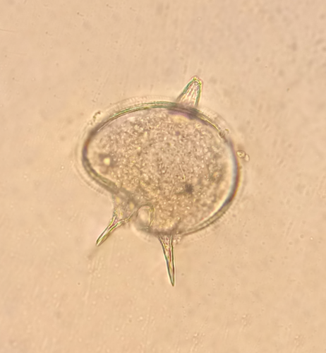 Protoperidinium bipes · iNaturalist United Kingdom