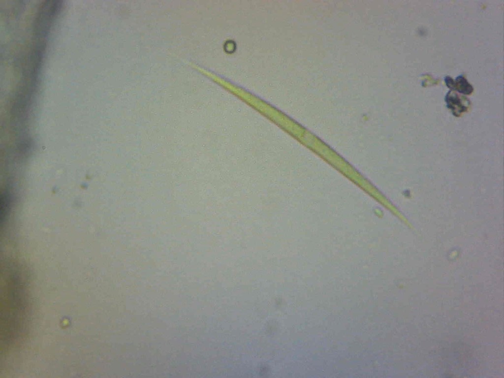 (Monoraphidium griffithii) - Botanical Realm