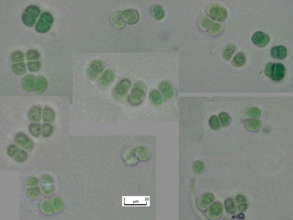 Chroococcus turgidus (Kütz.) Nägeli