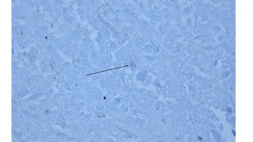 Mycobacterium gordonae · iNaturalist