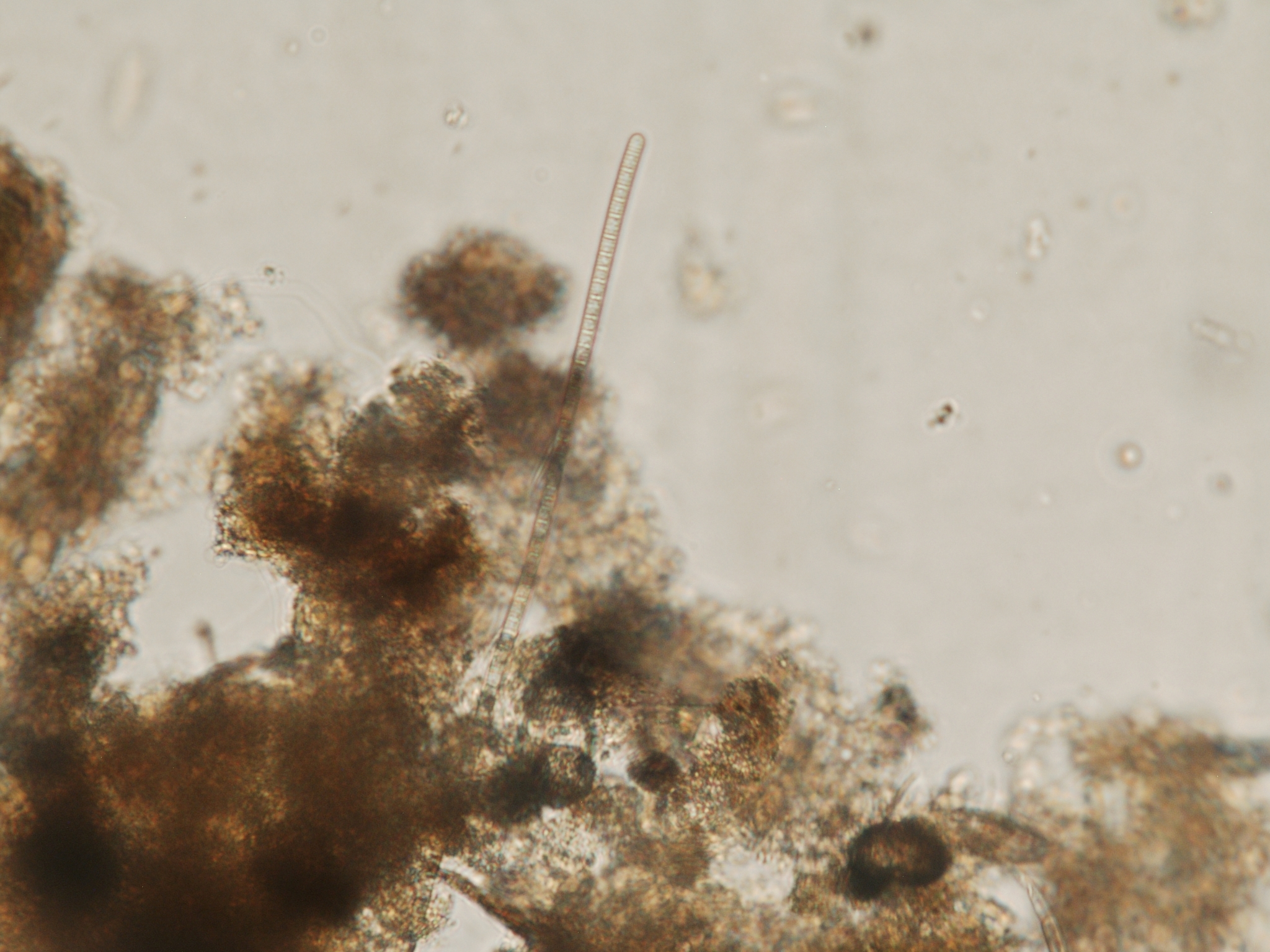 Phormidium Kützing ex Gomont, 1892