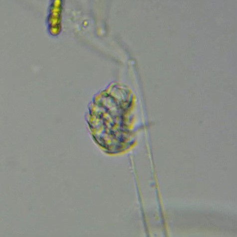 Aspidisca cicada (Müller, 1786) Claparède & Lachmann, 1858