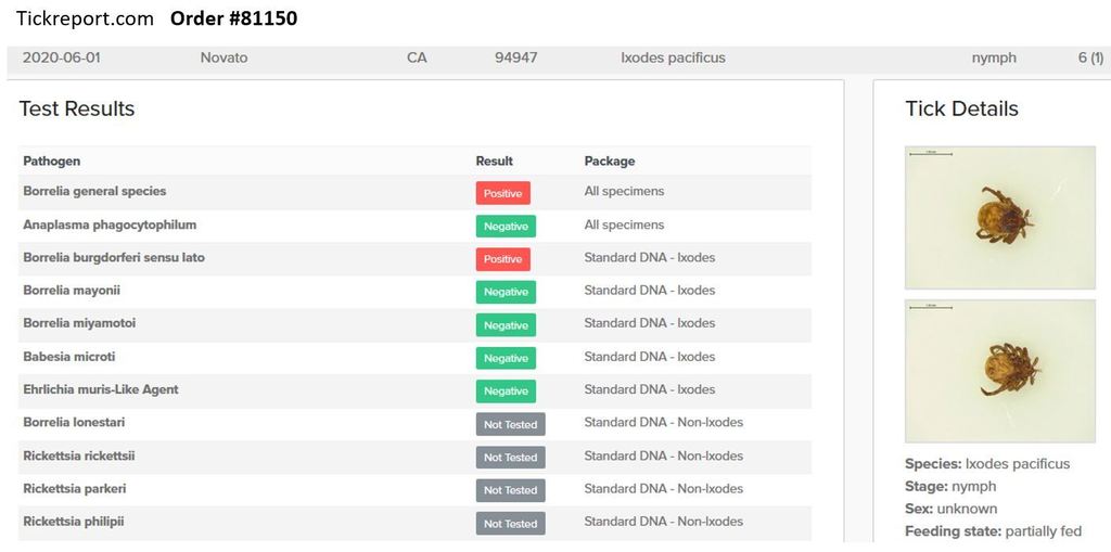 Lyme Disease Spirochete from Marin County, CA, USA on May 25, 2020 at ...