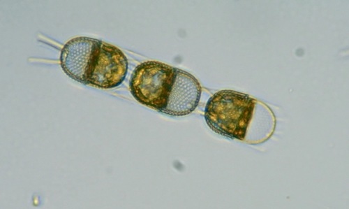 (Stephanopyxis nipponica)