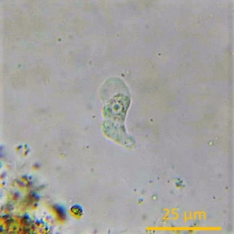 Vahlkampfidae (amoebas of the world) · iNaturalist